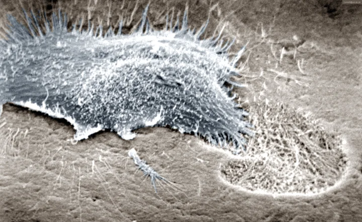 Knochenumbau - bone remodeling